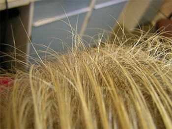 Trichology- Telogen Effluvium- severe shedding hair loss - AskMags.com