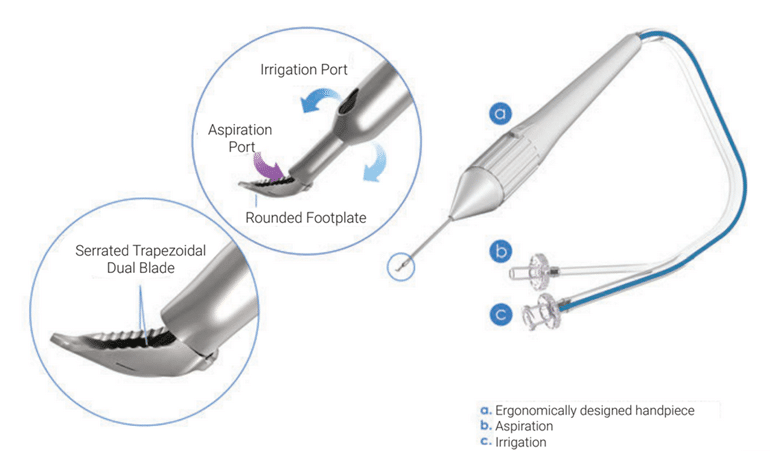 Results of Minimally Invasive Device TrabEx+ in Patients with Primary ...