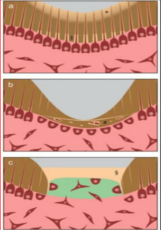 Re-Formation: Reactionary or Reparative Dentin - Athenaeum Scientific ...