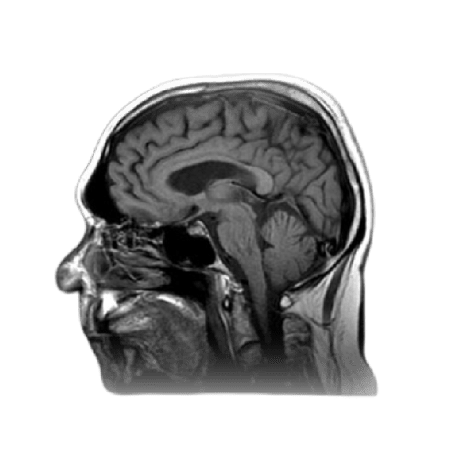 Dysarthria Speech Defect Recognition Github