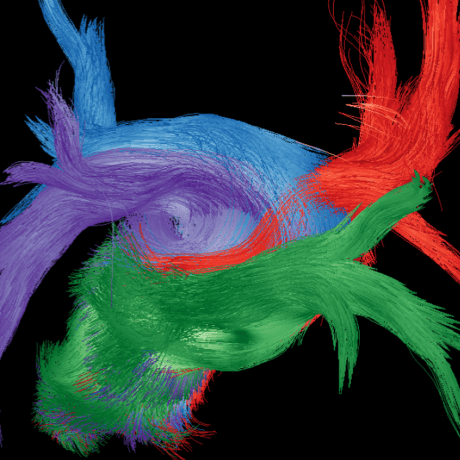 Fraser29 Fraser Callaghan Github