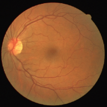Retinal Research Github