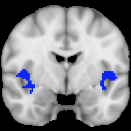 Nielsen Brain And Behavior Lab Github