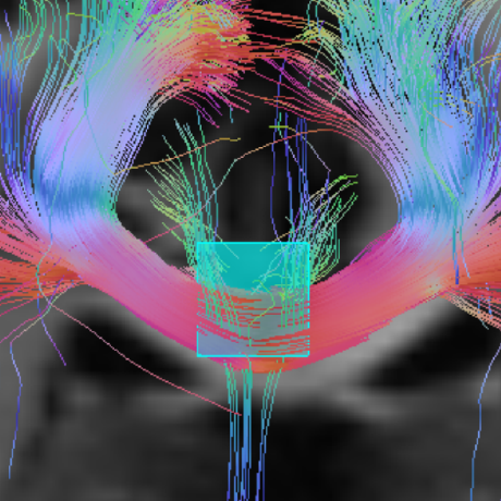 Github Diffusionmritool Dmritool Dmritool Is An Open Souce Toolbox