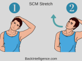 Sternocleidomastoid Stretch