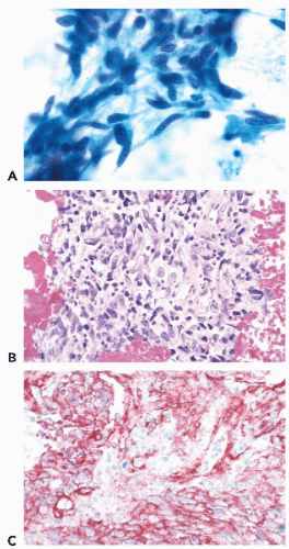 Lymph Nodes | Basicmedical Key