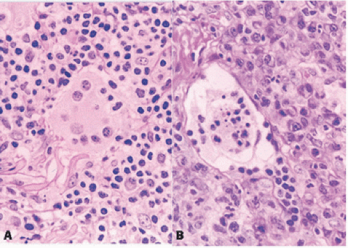 Synovium | Basicmedical Key