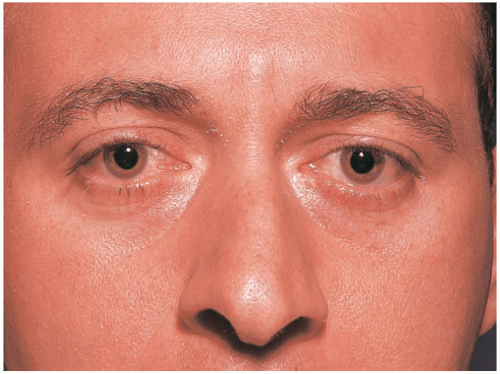 Vitamins, Trace Elements and Metals | Basicmedical Key