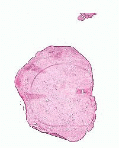 Eye and Ocular Adnexa | Basicmedical Key