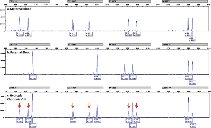 Specimen Identification Through Dna Analysis Basicmedical Key 3464