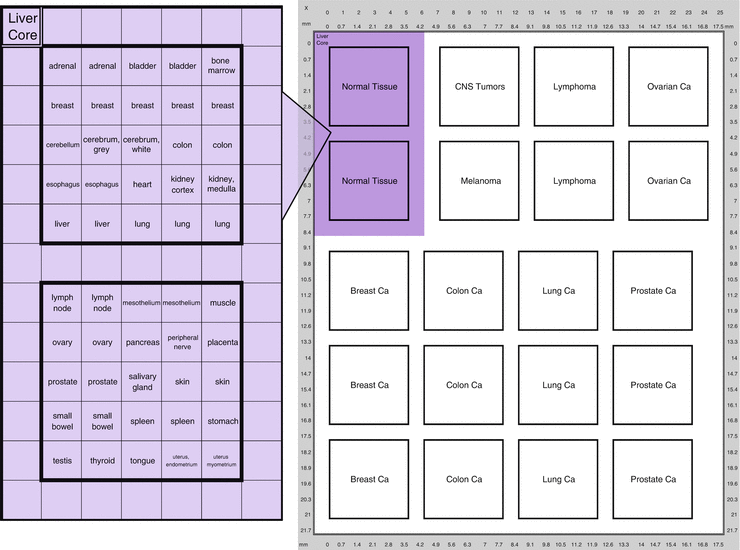 Tissue Microarray Technology And Its Potential Applications In