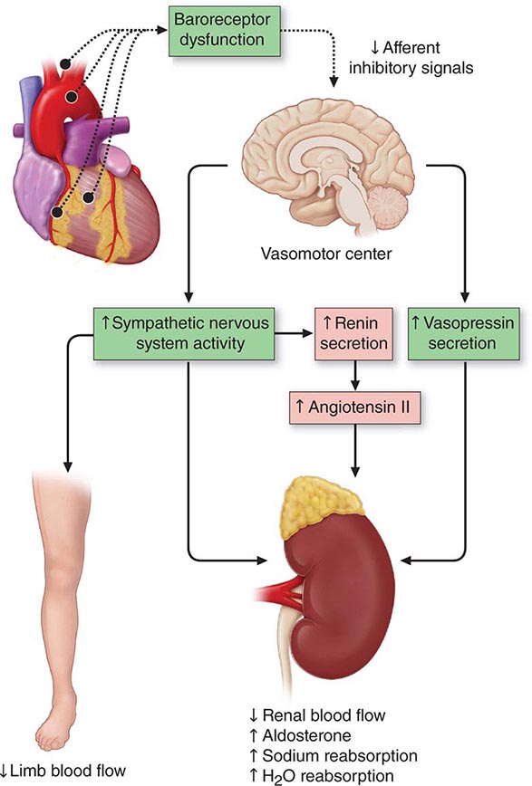 Heart Failure: Pathophysiology and Diagnosis | Basicmedical Key