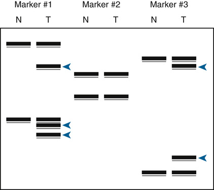 in Families | Basicmedical Key