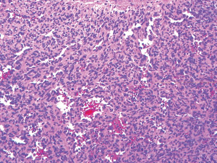 Cardiovascular Pathology | Basicmedical Key