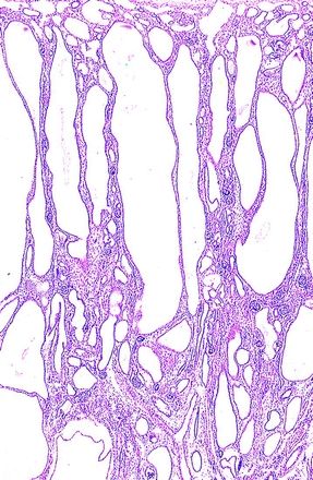 Developmental Abnormalities of the Kidney | Basicmedical Key