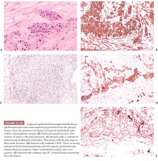Pleura | Basicmedical Key
