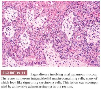 Anus and Perianal Area | Basicmedical Key