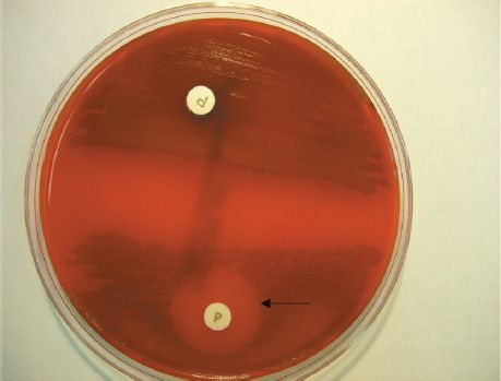 Gram-Positive Cocci | Basicmedical Key