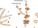 Opportunistic Mycoses Basicmedical Key