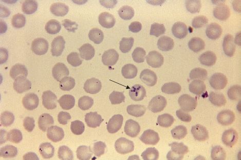 Minor Protozoan Pathogens | Basicmedical Key