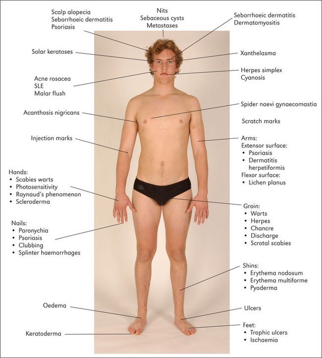 The skin, nails, and lumps | Basicmedical Key