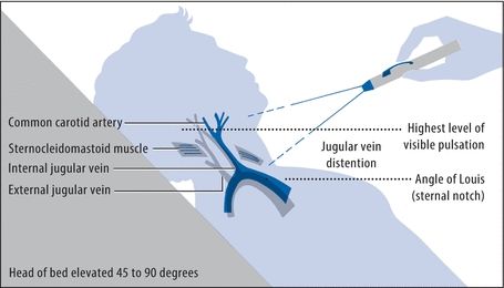 J | Basicmedical Key