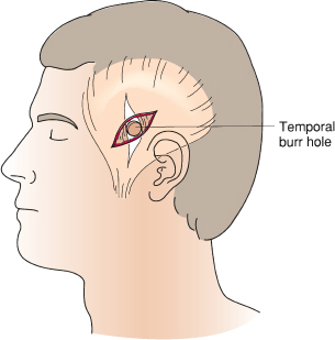 Head Trauma | Basicmedical Key
