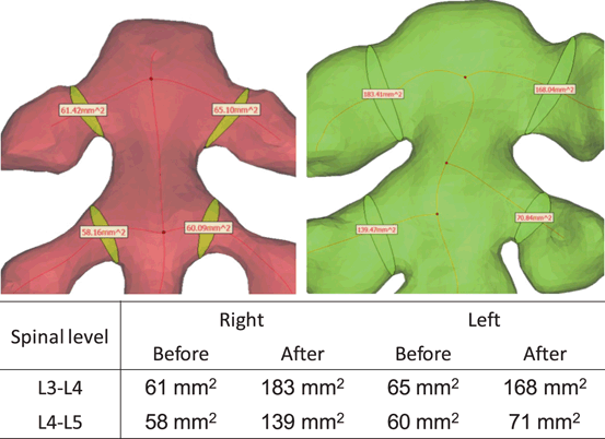 Planning of Surgical Treatment with the Use of 3D Visualization and ...