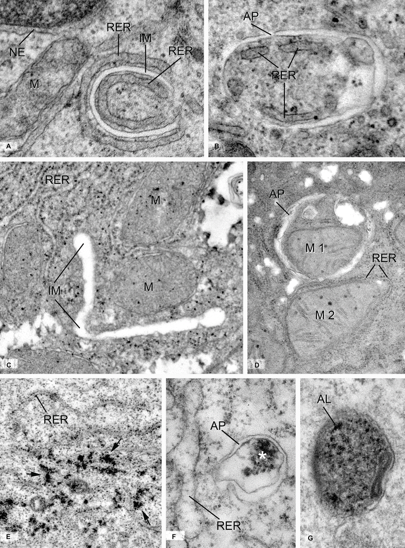 Cytoplasm: Autophagy | Basicmedical Key