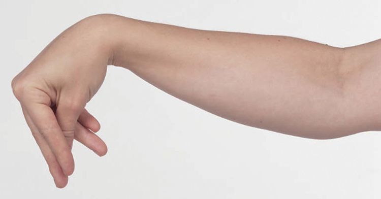 Disorders of Calcium Metabolism | Basicmedical Key