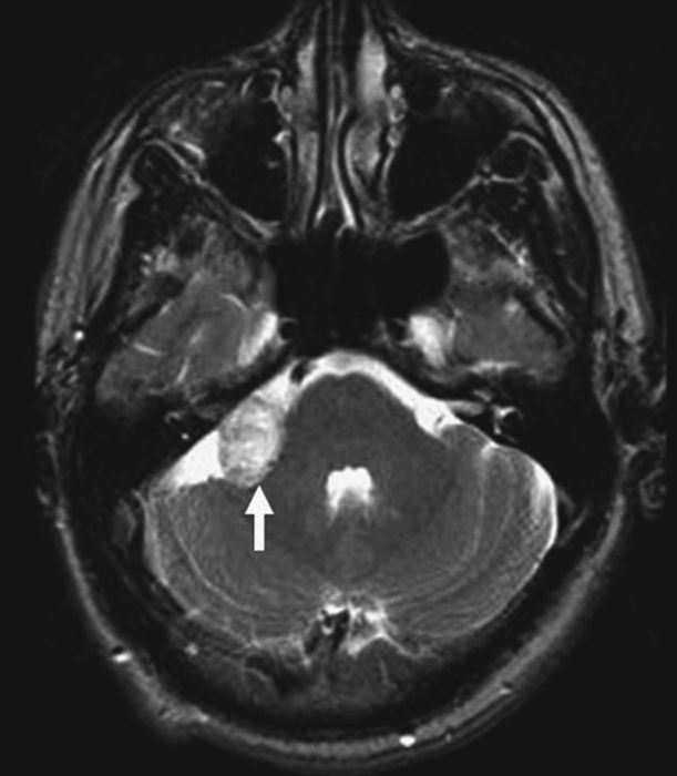 Neurology Summary | Basicmedical Key