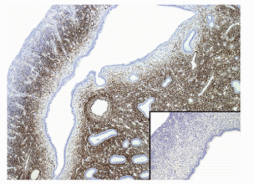 Cervix | Basicmedical Key
