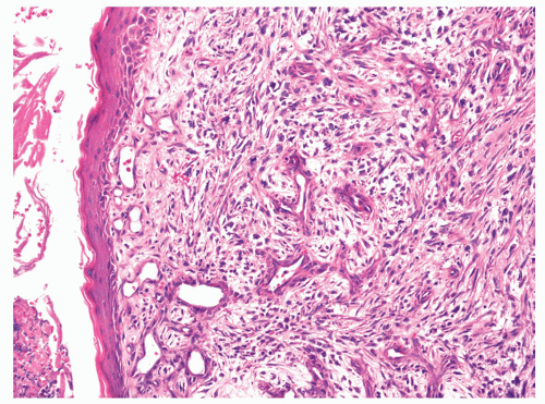Pathology of the Ear | Basicmedical Key