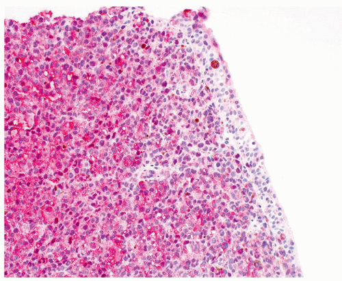 Bladder | Basicmedical Key