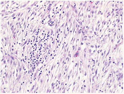 Vagina | Basicmedical Key