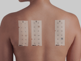 Patch Testing Bellaire Allergy Asthma