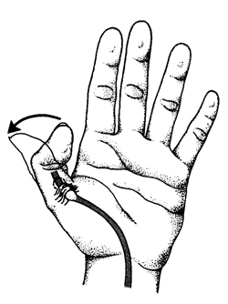 Tetik Parmak ( Trigger Finger ) – BEROVA KLİNİK - Ortopedi ve Travmatoloji - Orthopaedics and ...