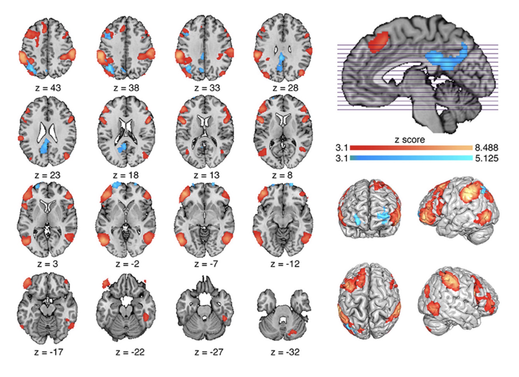 How Physics Makes Your Brain Light Up Big Think