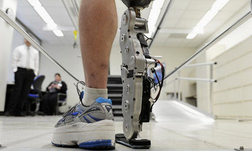 Neural Workaround Makes for More Practical Bionic Limbs