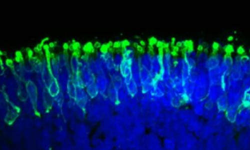 3-D Light-Sensitive Retina Made in the Lab