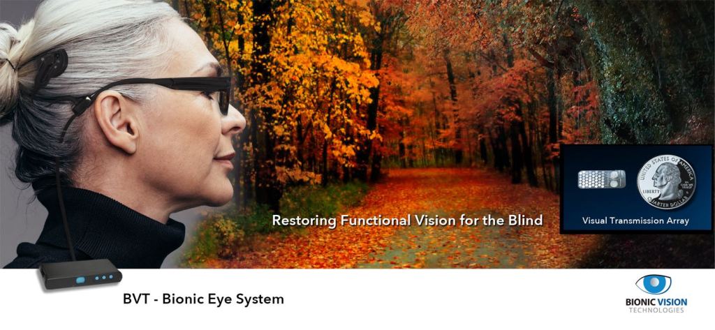 Home - Bionic Vision Technologies