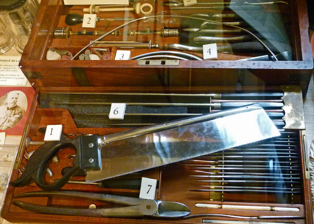 The old operating theatre - A Bit About Britain