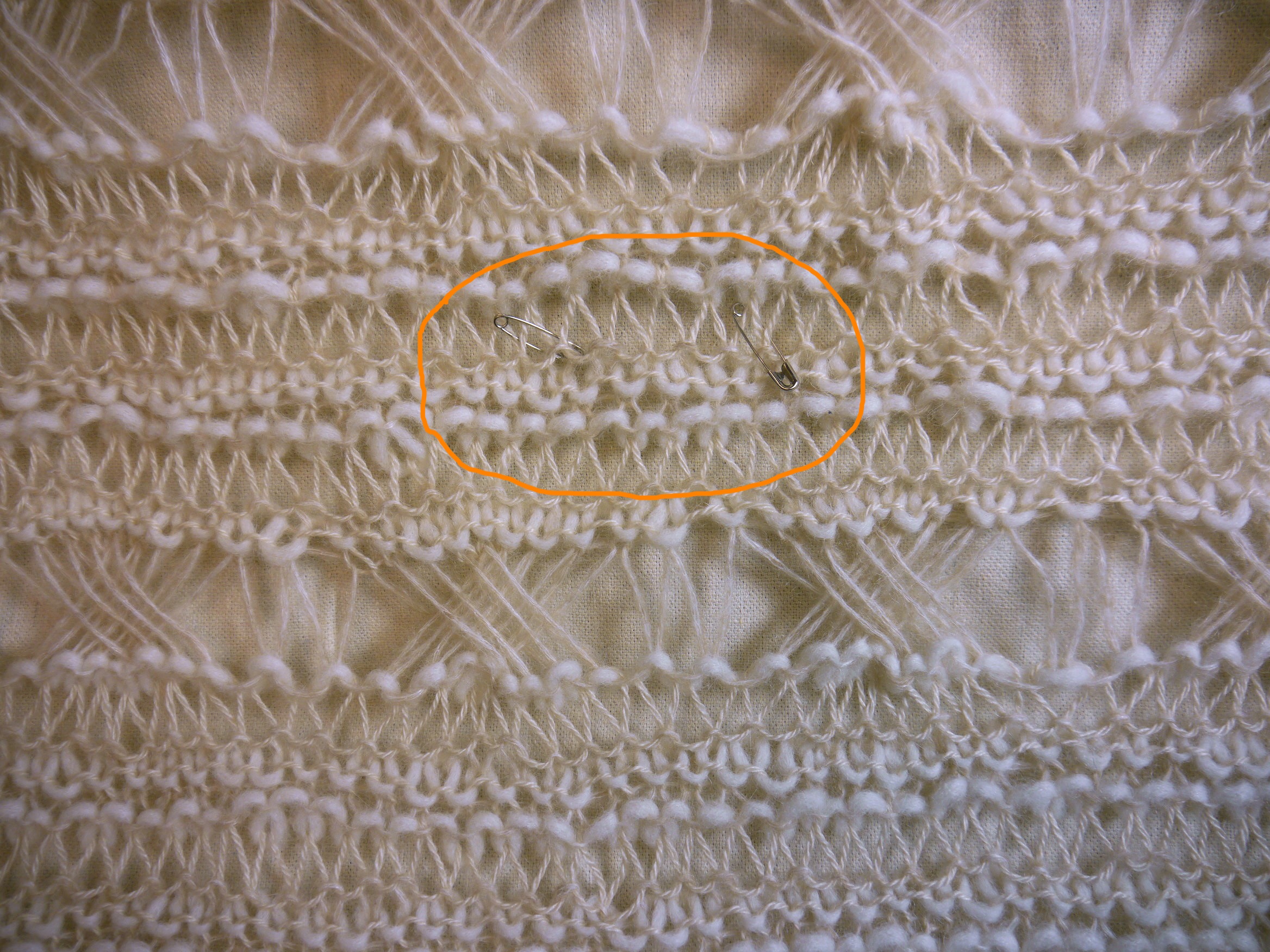 Emily Explains: Knitting Surgery – Design Team Blog