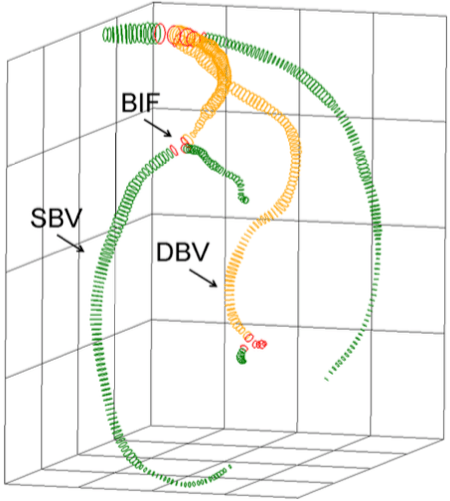 Know Your Mesh for CFD in Biomedical Applications - GridPro Blog