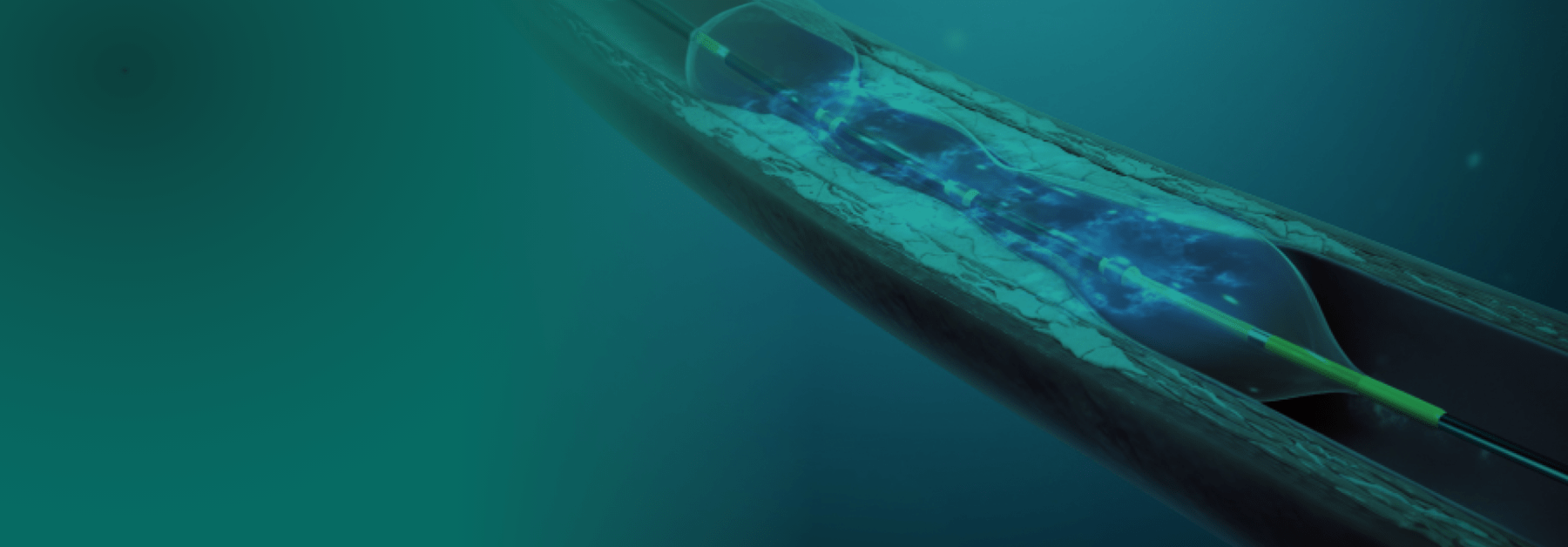 Creating A 13 Billion Dollar Brand Xds Blog