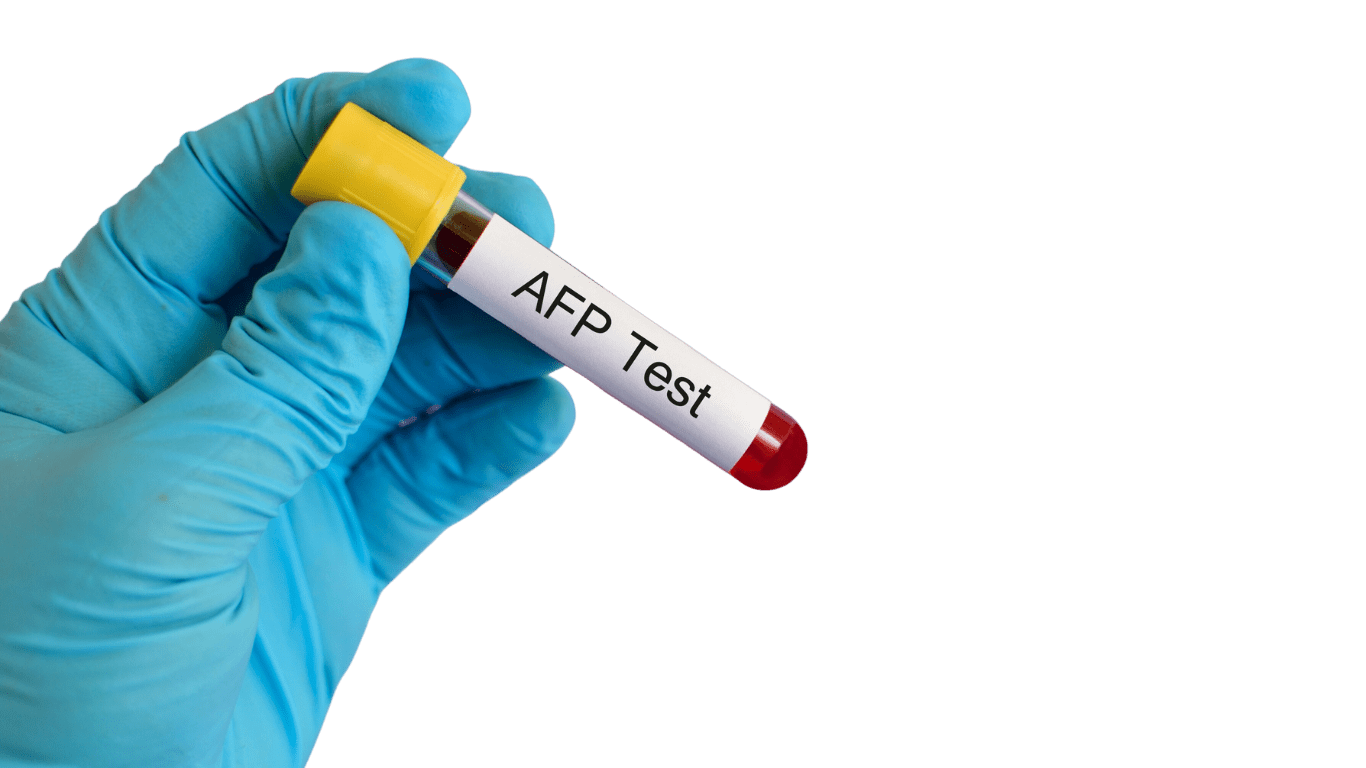 I nostri test ad IMMUNOFLUORESCENZA – BM Diagnostics