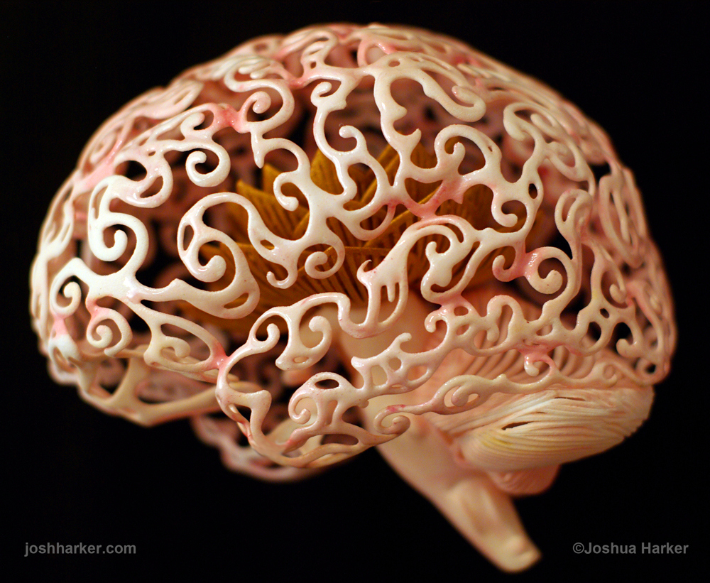 3D-printed filigree brain cuff | Boing Boing