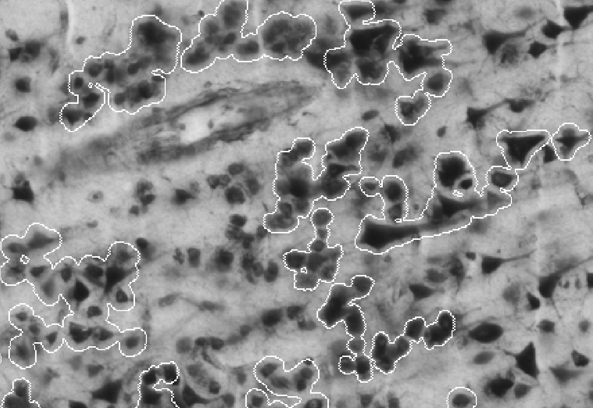 Neuronal clustering map with isotropic structuring element - Brain ...