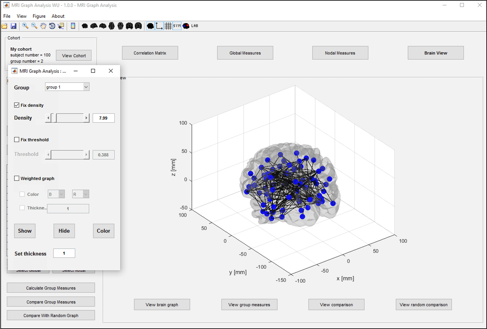 MRI Graph Analysis WU - BRAPH
