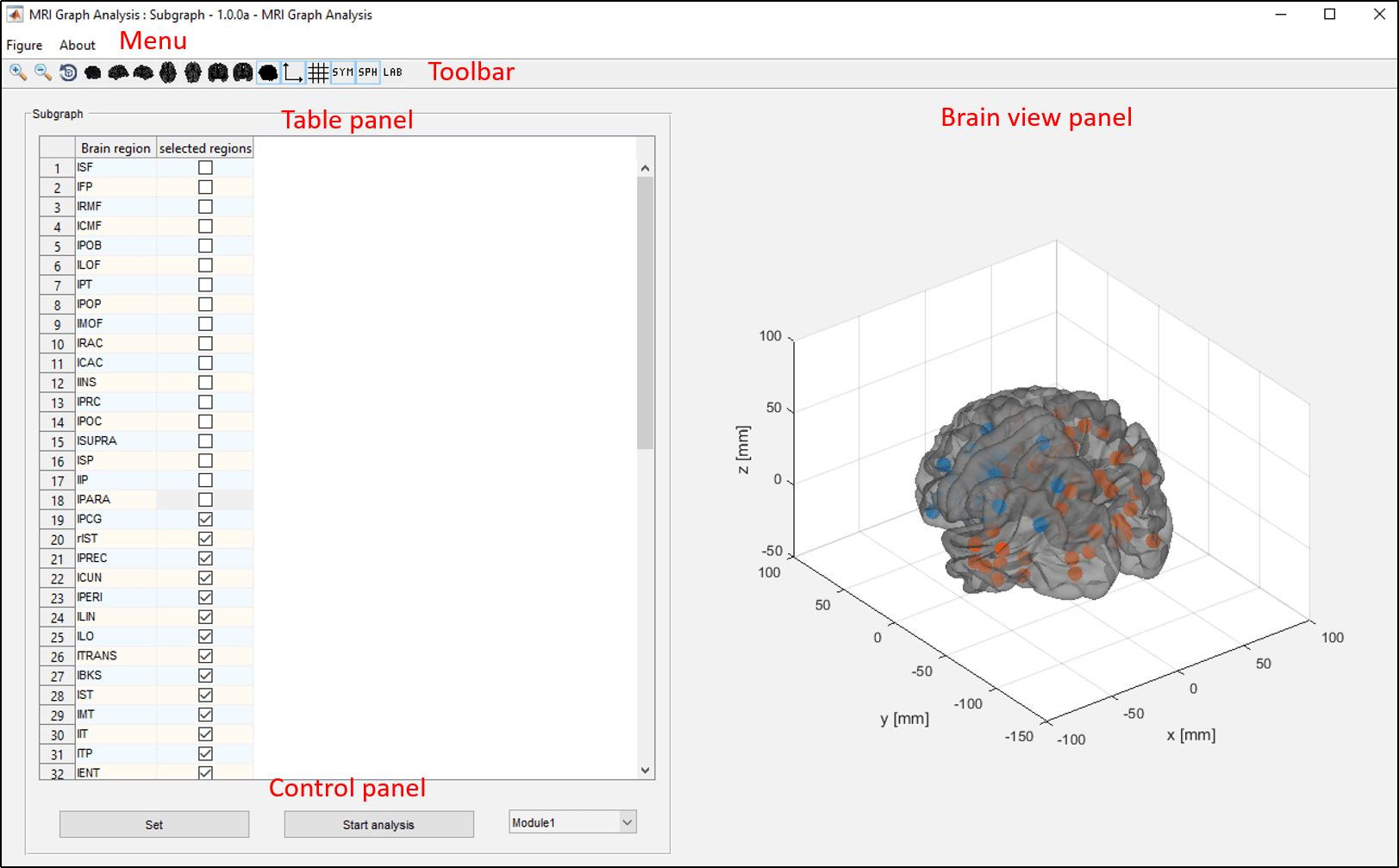 MRI Graph Analysis - BRAPH